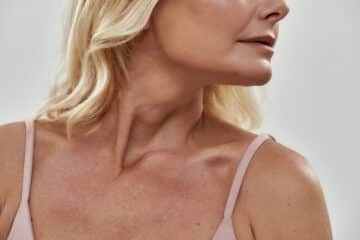 Fix Your Witches Chin | Non-Surgical and Surgical Solutions