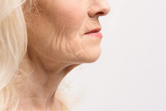 Reverse Aging Effects on Your Neck | Miami, FL