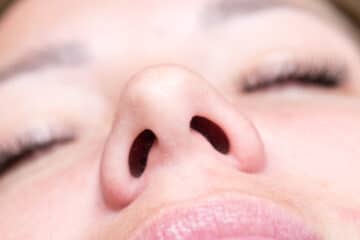 Minimize Scar Tissue After Rhinoplasty - Tips & Tricks | Miami