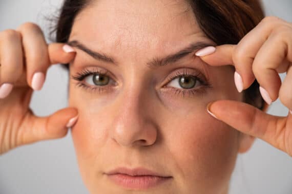 How to Manage Your Blepharoplasty Scars | Miami, FL