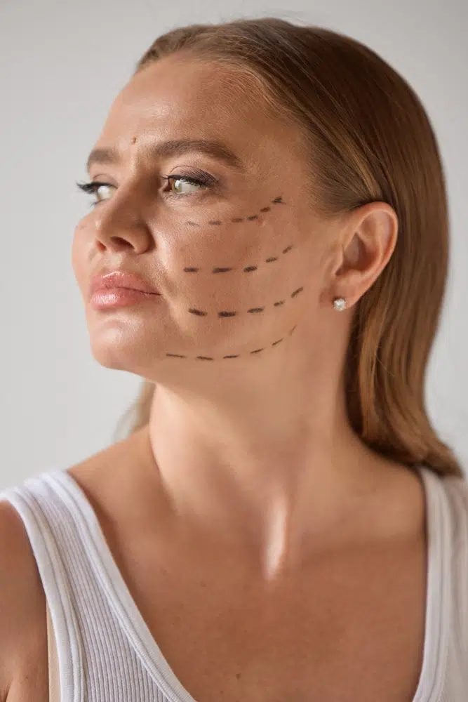 Why a Deep Plane Facelift Looks More Natural | Dr. Bustillo